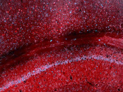Brain Secrets In A Blood Drop Rices Groundbreaking Gene Tracking