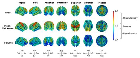 Are There Sex Differences In The Brain — Paradox Institute