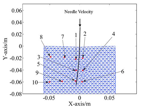 10 Observation Points In The Needle Insertion Procedure For The Download Scientific Diagram