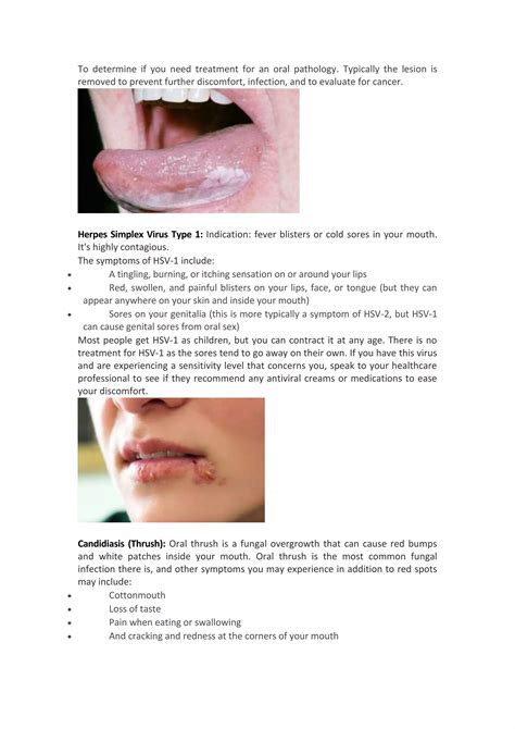 Common Oral Pathological Conditionsdoc