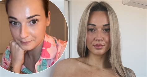 Mafs Tori Adams Hits Back At Cosmetic Surgery Critics After Posting A