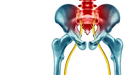 Can A Chiropractor Help With Sciatica Vida Integrated Health