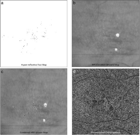 Post Imaging Process A Intraretinal Hyperreflective Foci Hrf Map