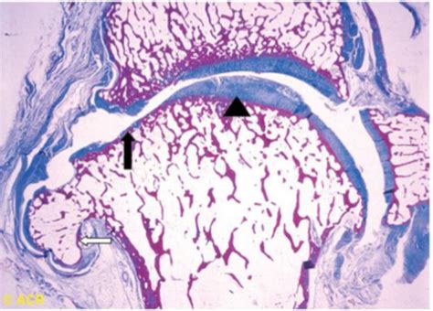 Lecture 17 Flashcards Quizlet