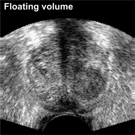 Intensity Shift Correlation Model Fig A Shows The Floating Volume Download Scientific
