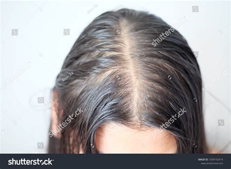 3 Hundred Long Haircuts Thin Hair Men Royalty Free Images Stock