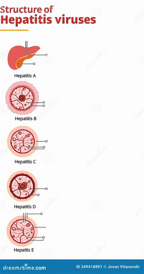 The Differences Between Viral And Bacterial Infections Vector