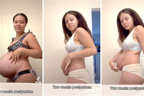 New Mom Shares What Her Stomach Looks Like 2 Weeks Postpartum