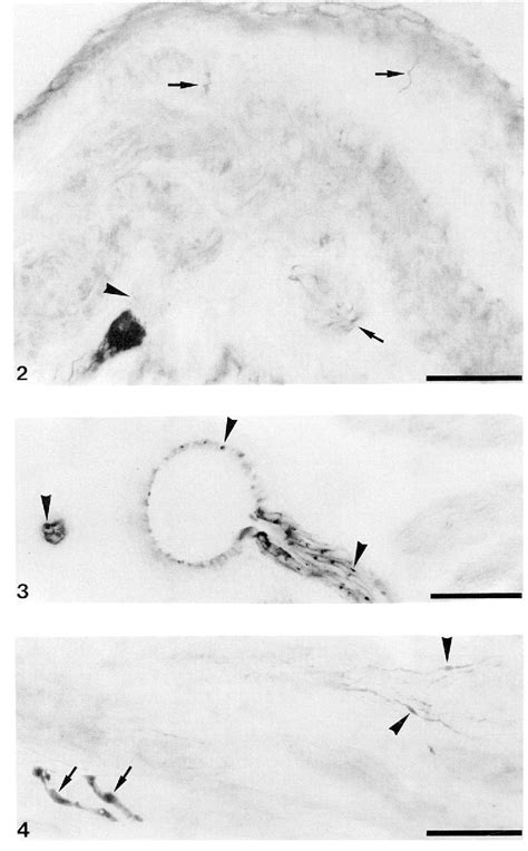 Structure Of Atrioventricular Node Semantic Scholar