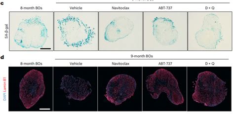 瑞孚迪explorer G3自动化整合系统助力类器官工程流水线制备 知乎