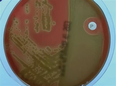 Mmsc428 Streptococcus Enterococcus And Strep Like Organisms