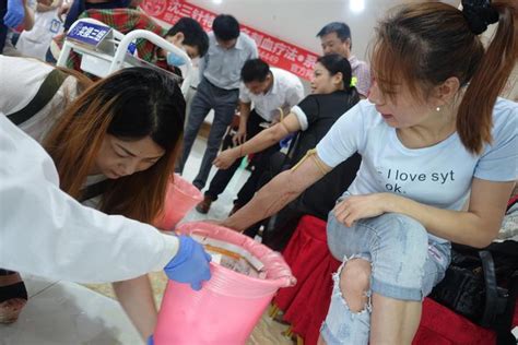 刺络放血疗法流出那么多血是否会伤害身体？ 知乎