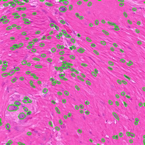 A Custom Cellpose Model For Hande Images Bioturing