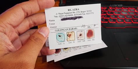 Sensor Pendeteksi Golongan Darah Sederhana Berbasis Arduino Dan Photodiode Elmech Technology