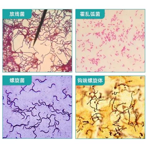 S89606cfb22c6452d94cdae47d2b5f4b1f