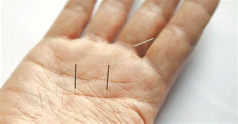 침 치료의 염증 제어 원리 신경과학으로 밝혀