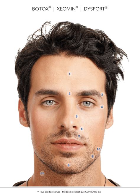 Enhance Your Beauty With Botox And Fillers Understanding Botox Units