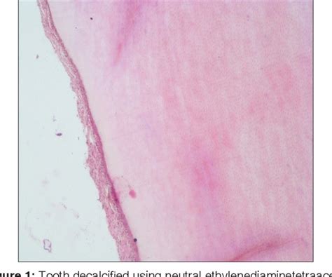 Figure 1 From Tooth Decalcification Using Different Decalcifying Agents