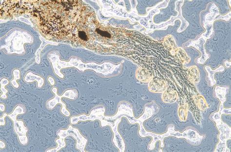 290点を超える犬鉤虫 写真のストックフォト、写真、そしてロイヤリティフリーの画像 Istock 290点を超える犬鉤虫 写真のストックフォト、写真、そしてロイヤリティフリーの画像 Istock