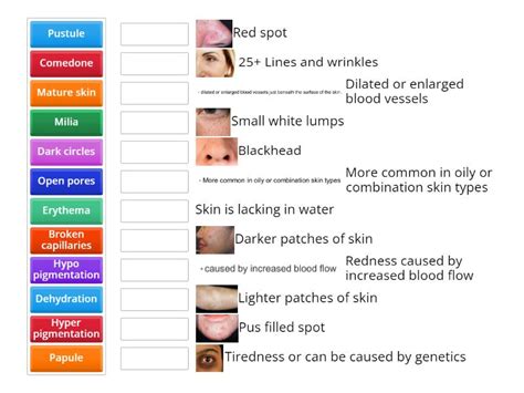 Skin Conditions Match Up