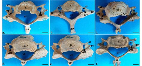 Classification Of Atf Types Based On Morphological Features A Type 1