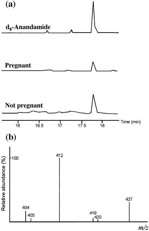 Gas Chromatographic Mass Spectrometric Gcms Analysis Select Ion