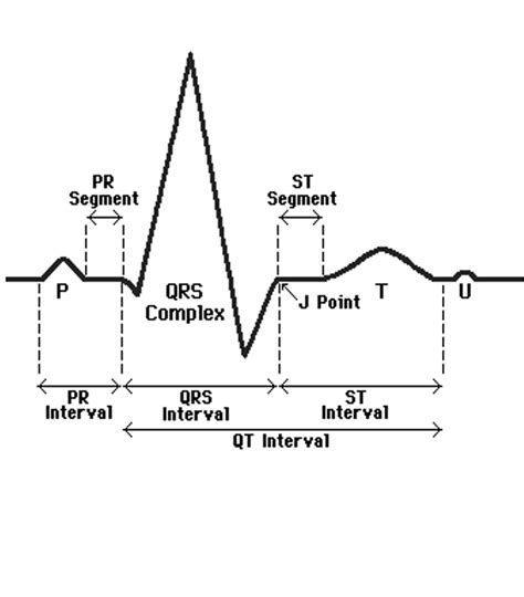 Arrhythmias And Management Diagram Quizlet