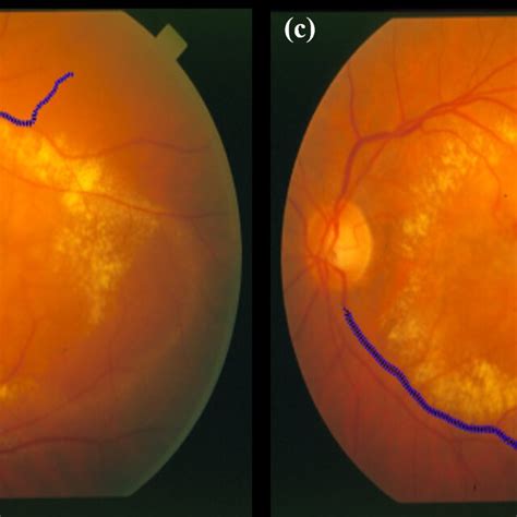 Vessel Extraction From The Input Image A Input Image 1 B Download Scientific Diagram