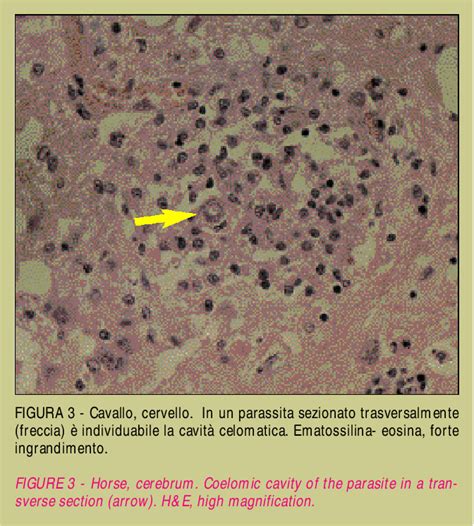 Figure 1 From Encefalite Granulomatosa Da Halicephalobus Gingivalis In Un Cavallo Halicephalobus
