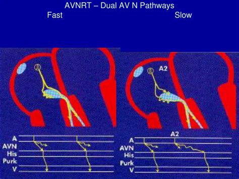 Ppt Pr Inciples Of E P His Bundle Mapping Techniques Powerpoint Presentation Id4978187