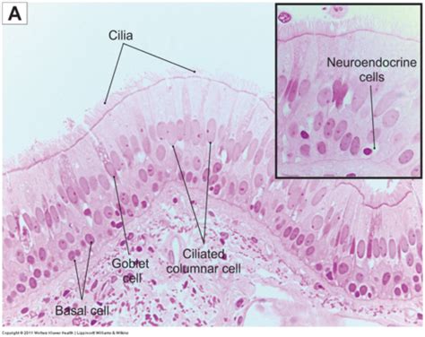 Final Lab Exam Flashcards Quizlet Final Lab Exam Flashcards Quizlet