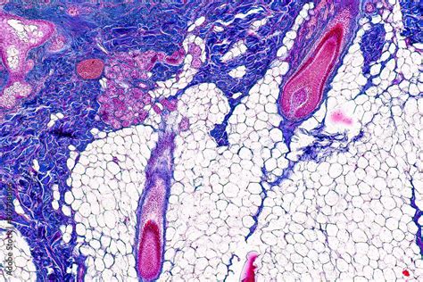 Scalp And Hair Follicles Of Human Under The Microscope In Lab Stock Photo Adobe Stock