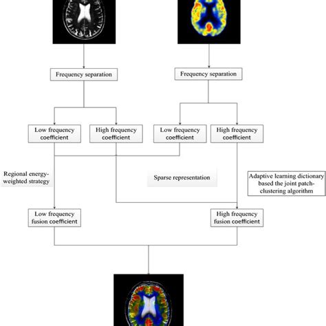 multi modality medical image fusion by the proposed method the left download scientific
