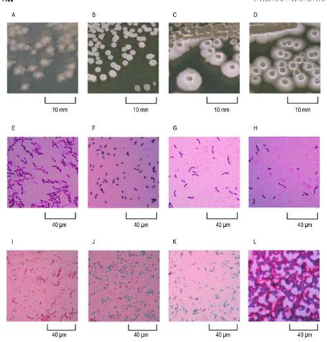 Bacterial Colony Morphology And Identification Of Bacteria