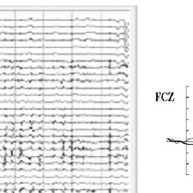 EEG Waveforms Following Amplification And Extracted ERP Waveforms From Download Scientific
