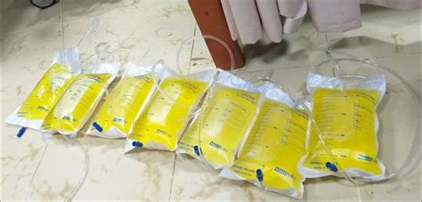 Dr Khaled Fouad On Linkedin Cardiofix Ecmo Stories First Day On Ecmo