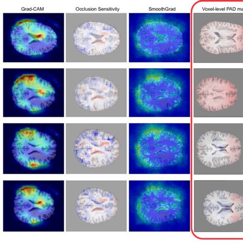 Traditional Interpretability Methods Left To Right Grad Cam Occlusion Download Scientific
