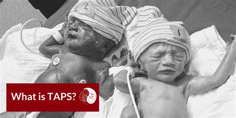 The Taps Support Foundation What Is Taps In Twins