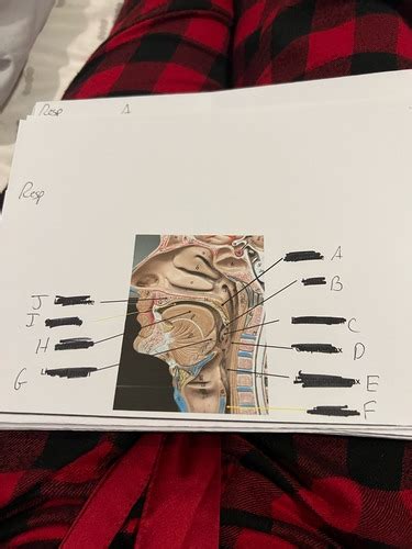 Resp Practical Flashcards Quizlet