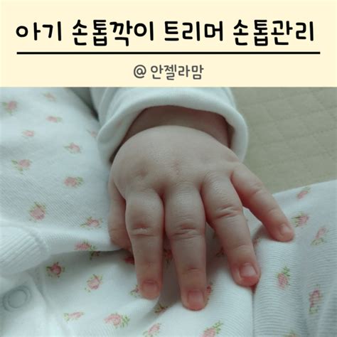 아기 손톱깎이 트리머 손톱관리 방법 네이버 블로그