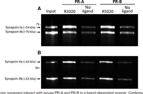 Figure 1 From The Progestin Receptor Interactome In The Female Mouse