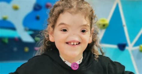 코 없이 태어났지만 밝게 웃는 10세 소녀전세계 응원 물결