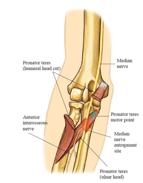 Pronator Teres Motor Point And Its Multiple Functions Acusport Education