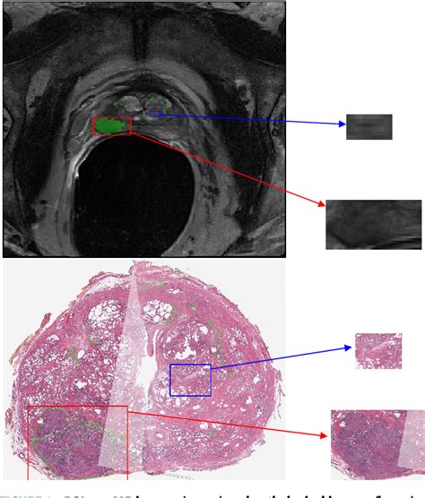Figure 2 From Augmented Radiology Feature Space Transfer Model For