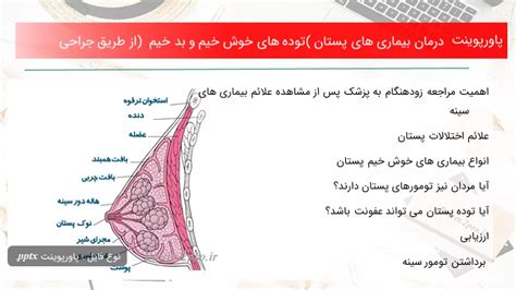 دانلود پاورپوینت درمان بیماری های پستان توده های خوش خیم و بد خیم از