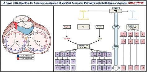 The Heart 🔴a Novel Ecg Algorithm For Accurate Localization Of