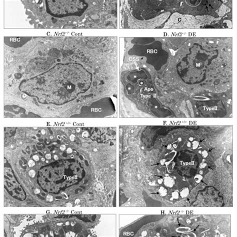 Electron Microscopic Analysis Of Alveolar Macrophages And Alveolar Type Download Scientific