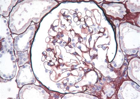 Renal Path 1and2 Flashcards Quizlet