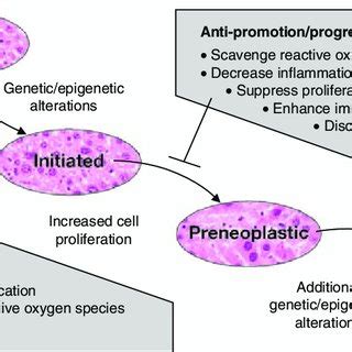 Multistep Carcinogenesis Pathway A Schematic Presentation Of The