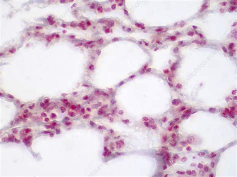 Human Lung Tissue Light Micrograph Stock Image F0412222 Science